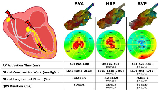 Three-Dimensional Electro-Anatomical Mapping and Myocardial Work ...