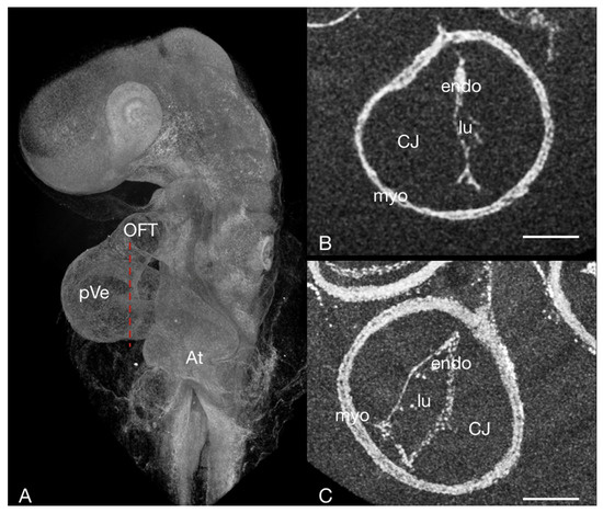 OCT Meets micro-CT: A Subject-Specific Correlative Multimodal Imaging ...
