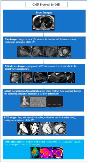 The Role of Cardiovascular Magnetic Resonance in Patients with Mitral ...
