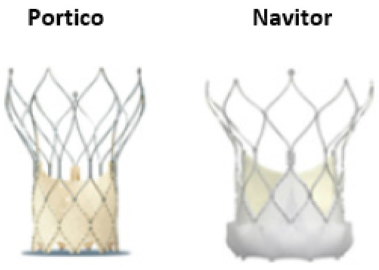 Personalised Treatment in Aortic Stenosis: A Patient-Tailored ...
