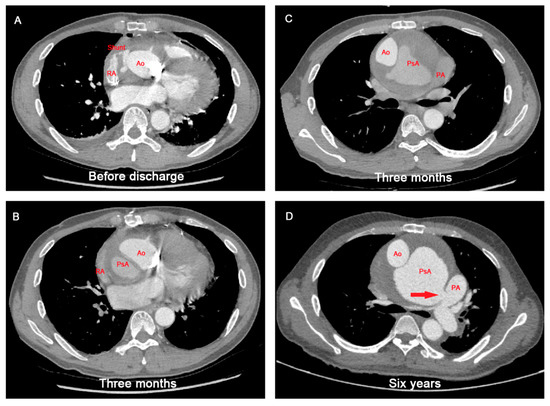 Journal of Cardiovascular Development and Disease | An Open Access ...