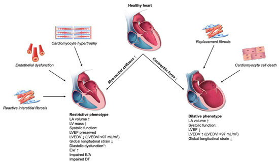 Role of Echocardiography in Diabetic Cardiomyopathy: From Mechanisms to ...