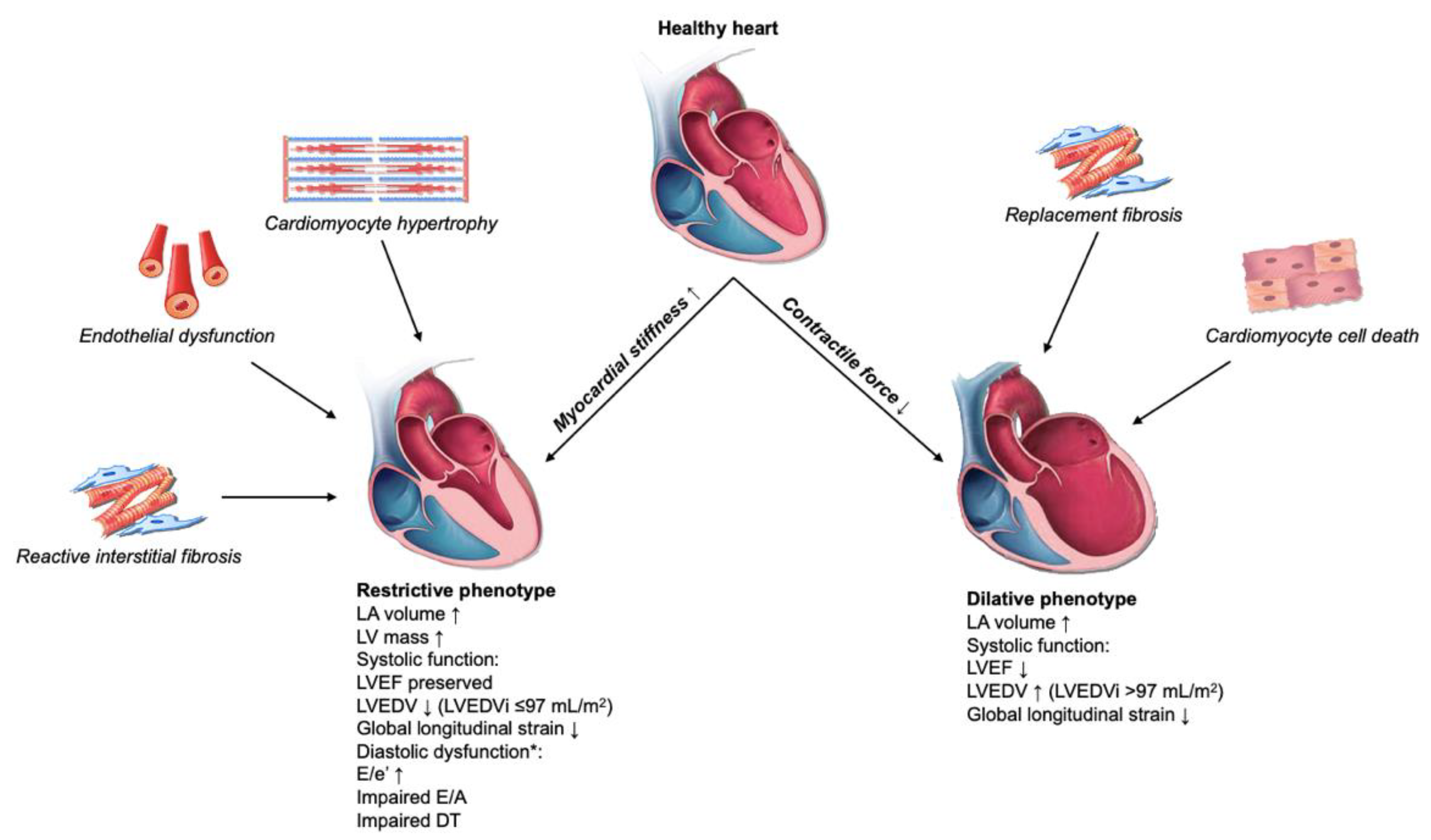 Role of Echocardiography in Diabetic Cardiomyopathy: From Mechanisms to ...