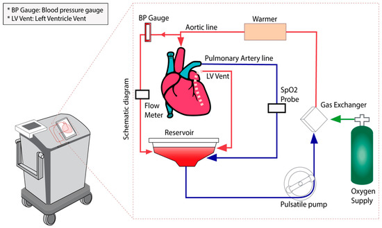 JCDD | Free Full-Text | Ex-Vivo Preservation of Heart Allografts—An ...