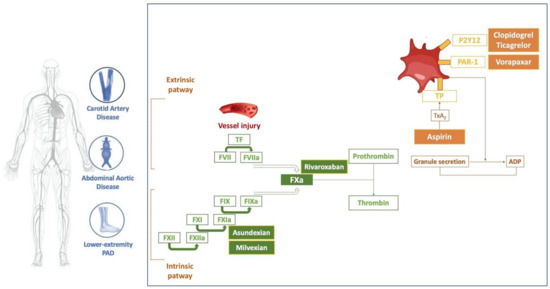 Antithrombotic Therapy in Peripheral Artery Disease: Current Evidence ...