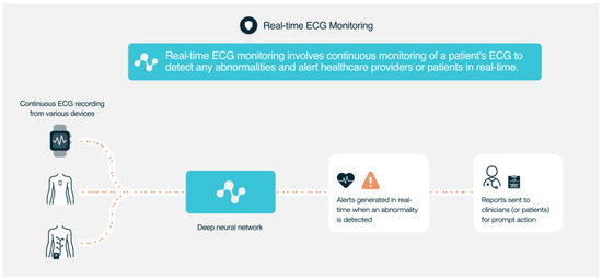 Current and Future Use of Artificial Intelligence in Electrocardiography