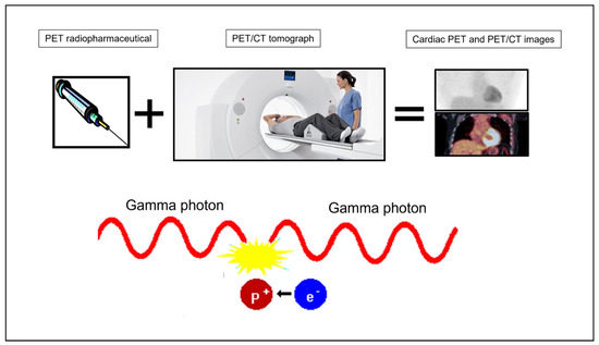 Positron Emission Tomography in Heart Failure: From Pathophysiology to ...