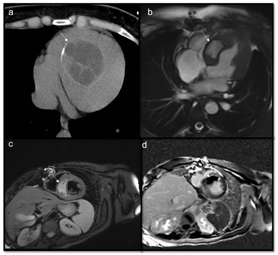 Practical Guide to Interpreting Cardiac Magnetic Resonance in Patients ...