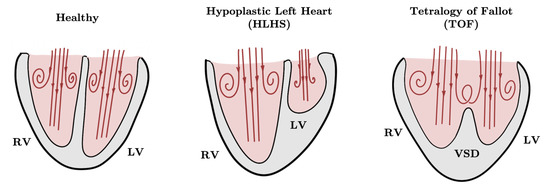 Recasting Current Knowledge of Human Fetal Circulation: The Importance ...
