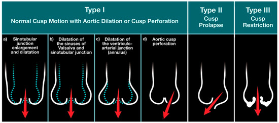 Contemporary Evaluation and Clinical Treatment Options for Aortic ...