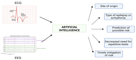 Mapping of Neuro-Cardiac Electrophysiology: Interlinking Epilepsy and ...