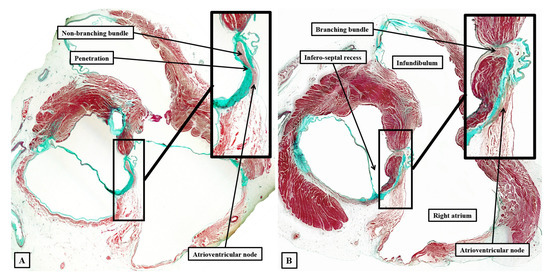 The Atrioventricular Conduction Axis Revisited for the 21st Century