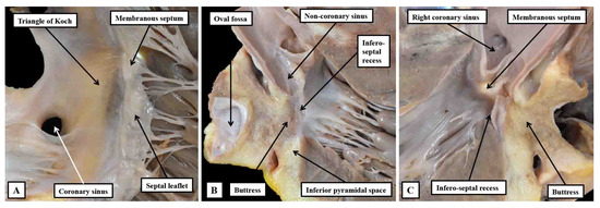 The Atrioventricular Conduction Axis Revisited for the 21st Century