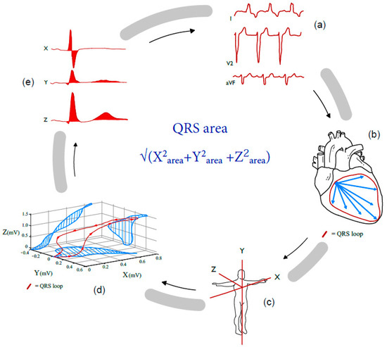Exploring QRS Area beyond Patient Selection in CRT—Can It Guide Left ...