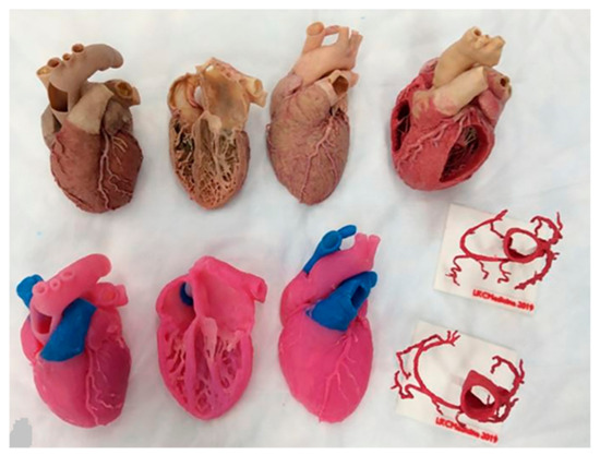 Cardiovascular Computed Tomography in the Diagnosis of Cardiovascular ...