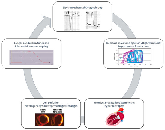 JCDD | Free Full-Text | Current Role of Electrocardiographic Imaging in ...