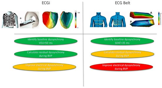 JCDD | Free Full-Text | Current Role of Electrocardiographic Imaging in ...