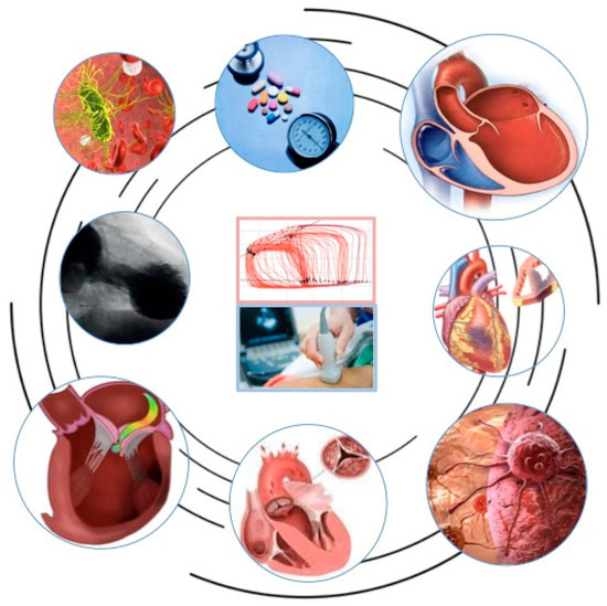 Development and Clinical Application of Left Ventricular–Arterial ...