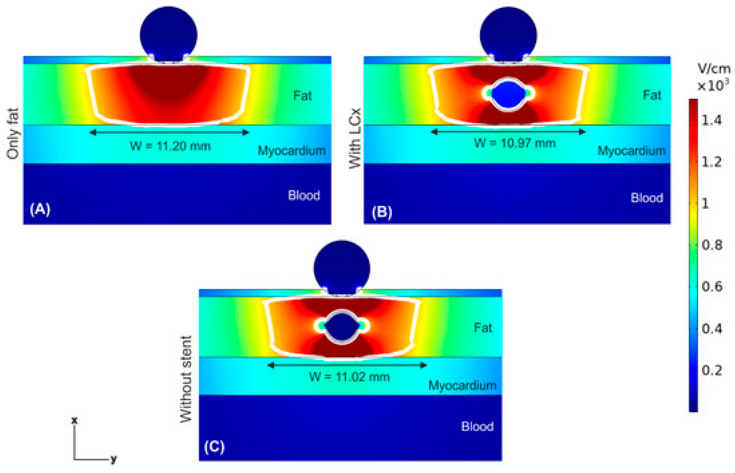 A New Hope for the Treatment of Atrial Fibrillation: Application of ...