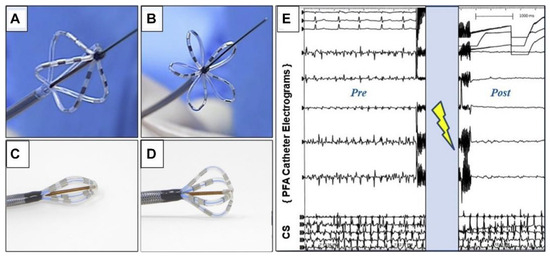 A New Hope for the Treatment of Atrial Fibrillation: Application of ...