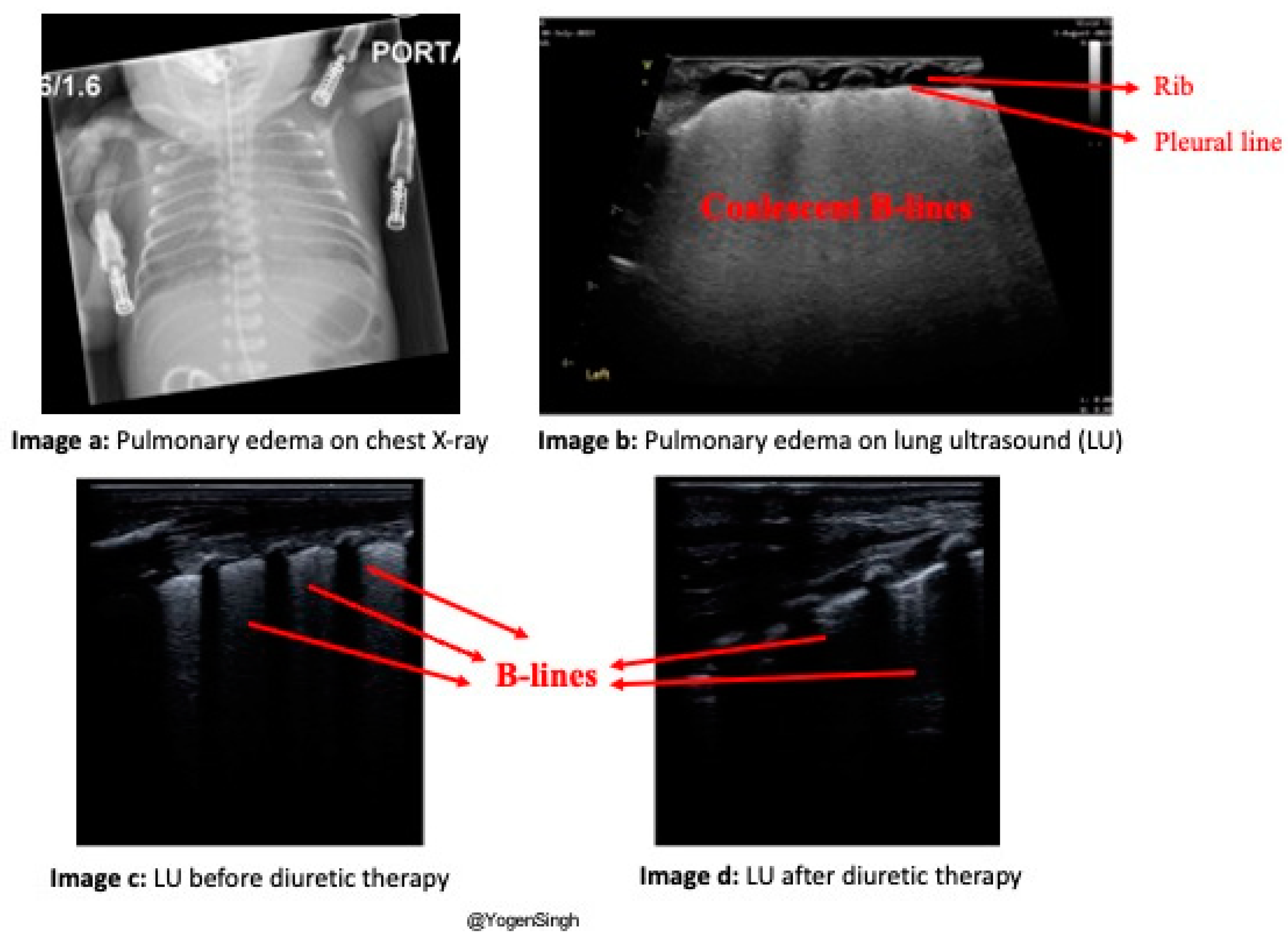 JCDD | Free Full-Text | Narrative Review on Echocardiographic ...