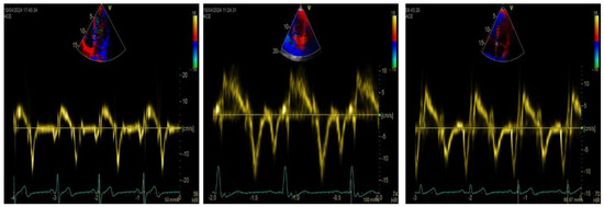 Current and Clinically Relevant Echocardiographic Parameters to Analyze ...