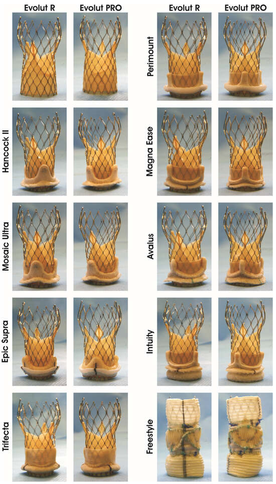 JCDD | Free Full-Text | Comparison of Two Generations of Self ...