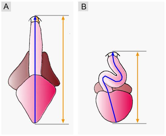 JCDD | Free Full-Text | The Functional Significance of Cardiac Looping ...