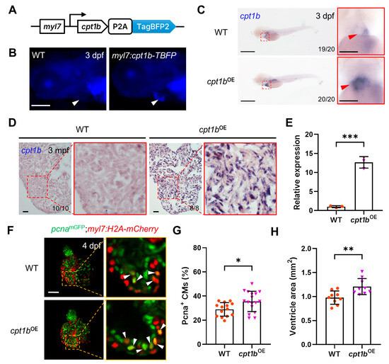 cpt1b Regulates Cardiomyocyte Proliferation Through Modulation of ...