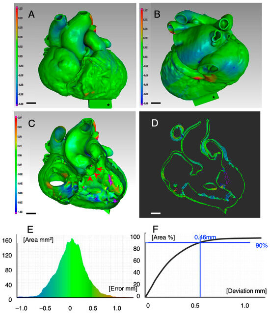 Evaluation of the Efficacy and Accuracy of Super-Flexible Three ...