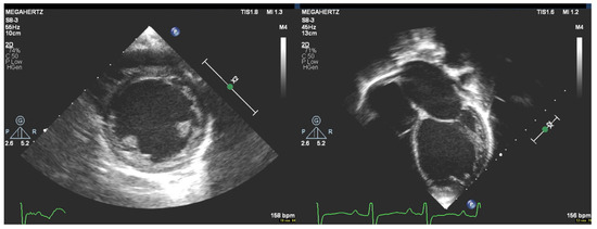 The Introduction of a New Mobile Driving Unit for a Ventricular Assist ...