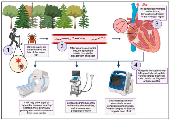 Cardiac Magnetic Resonance Imaging in Lyme Carditis—A Case Series and ...