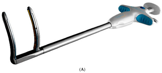 A Hybrid Minimally Invasive Atrial Fibrillation Ablation Procedure ...