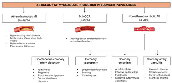 Myocardial Infarction in the Young: Aetiology, Emerging Risk Factors ...