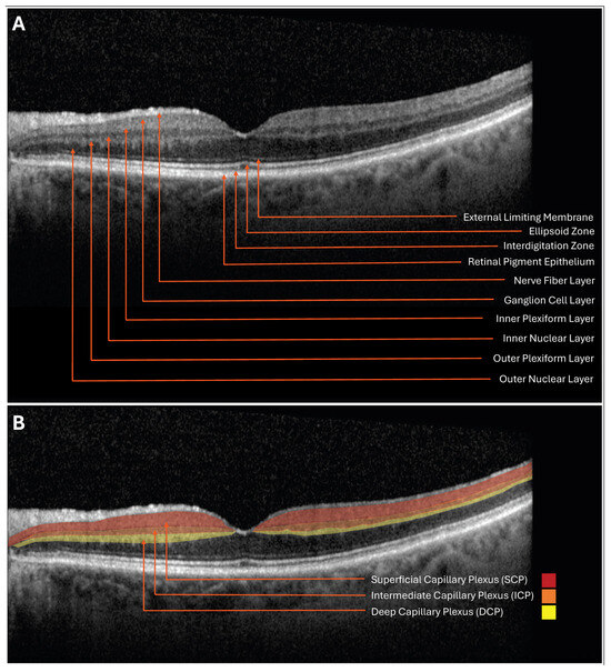 Retinal Imaging as a Window into Cardiovascular Health: Towards Harnessing Retinal Analytics for ...