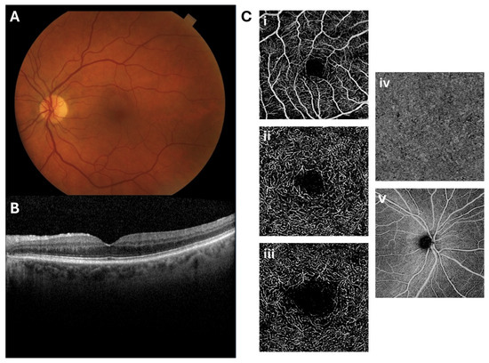 Retinal Imaging as a Window into Cardiovascular Health: Towards Harnessing Retinal Analytics for ...