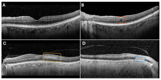 Retinal Imaging as a Window into Cardiovascular Health: Towards Harnessing Retinal Analytics for ...