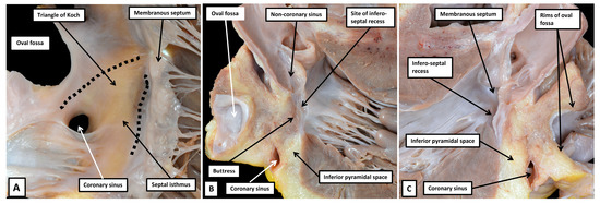 The Anatomy of the Atrioventricular Node