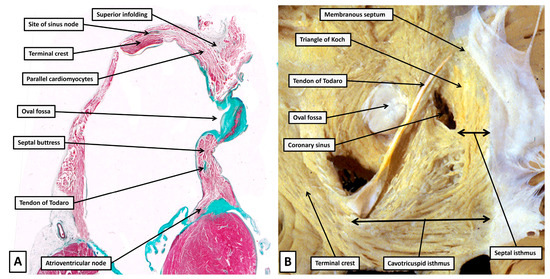 The Anatomy of the Atrioventricular Node