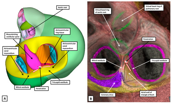 The Anatomy of the Atrioventricular Node