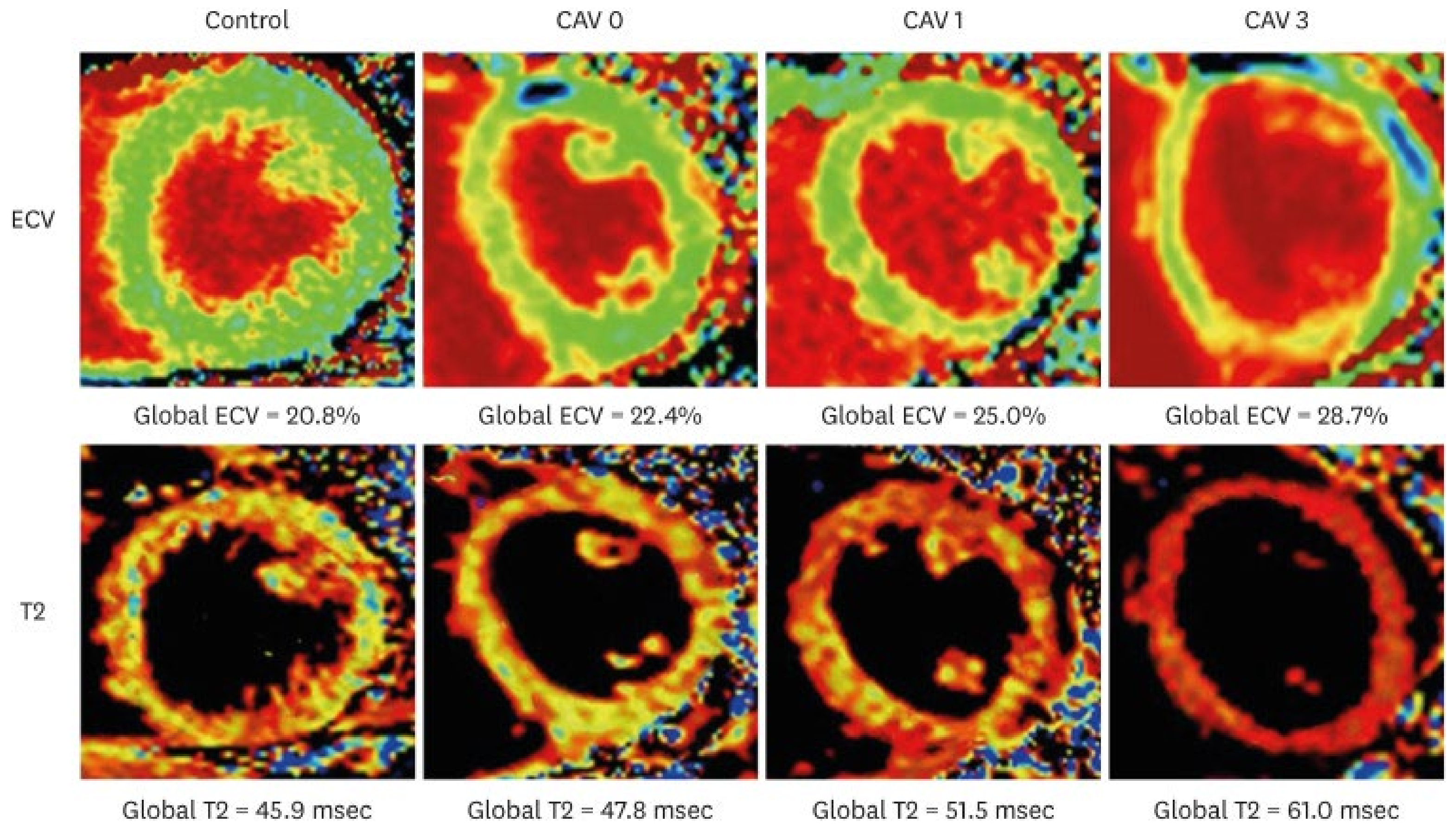 Role of Computed Tomography and Other Non-Invasive and Invasive Imaging ...