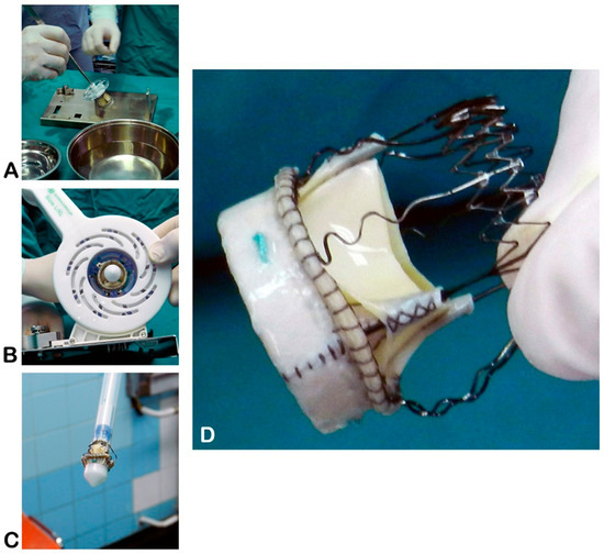 Comparison of Surgical Treatment Outcomes in Patients with Symptomatic ...