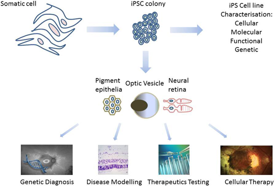 JCM | Free Full-Text | iPS Cells for Modelling and Treatment of Retinal ...