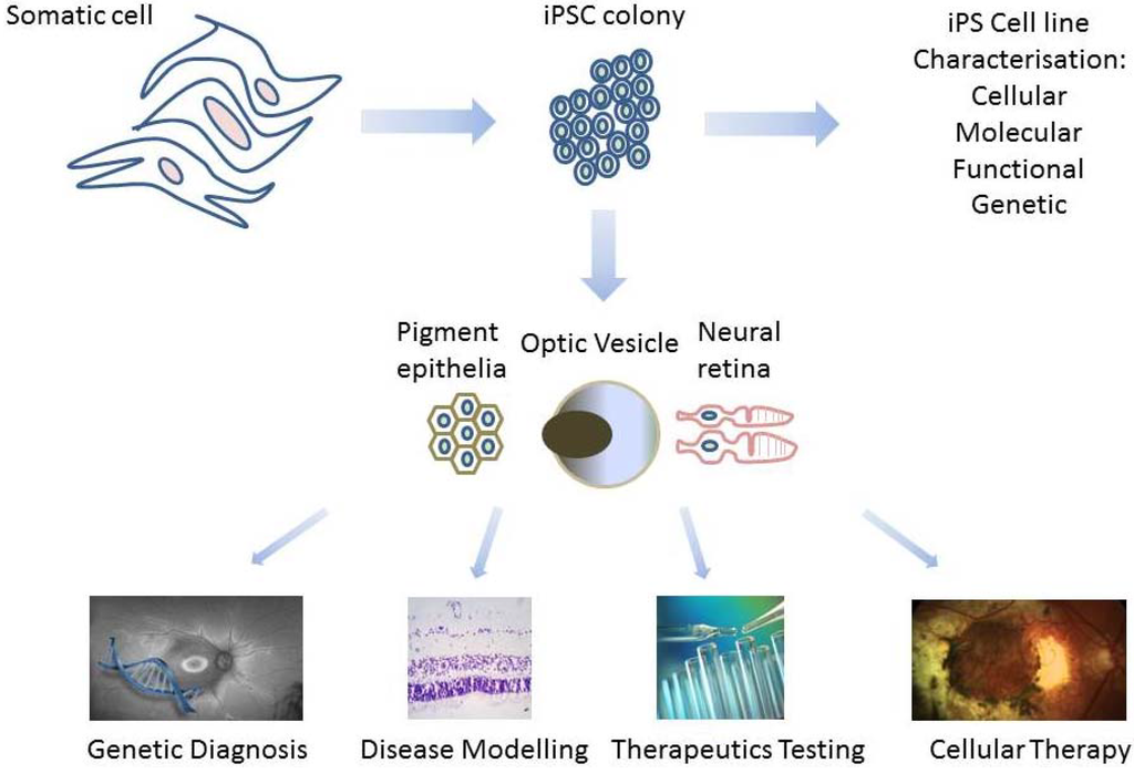 JCM | Free Full-Text | iPS Cells for Modelling and Treatment of Retinal ...