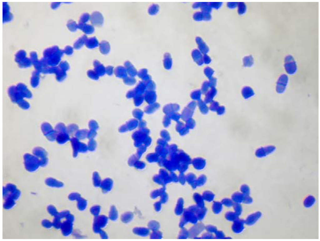 The Role of Malassezia spp. in Atopic Dermatitis