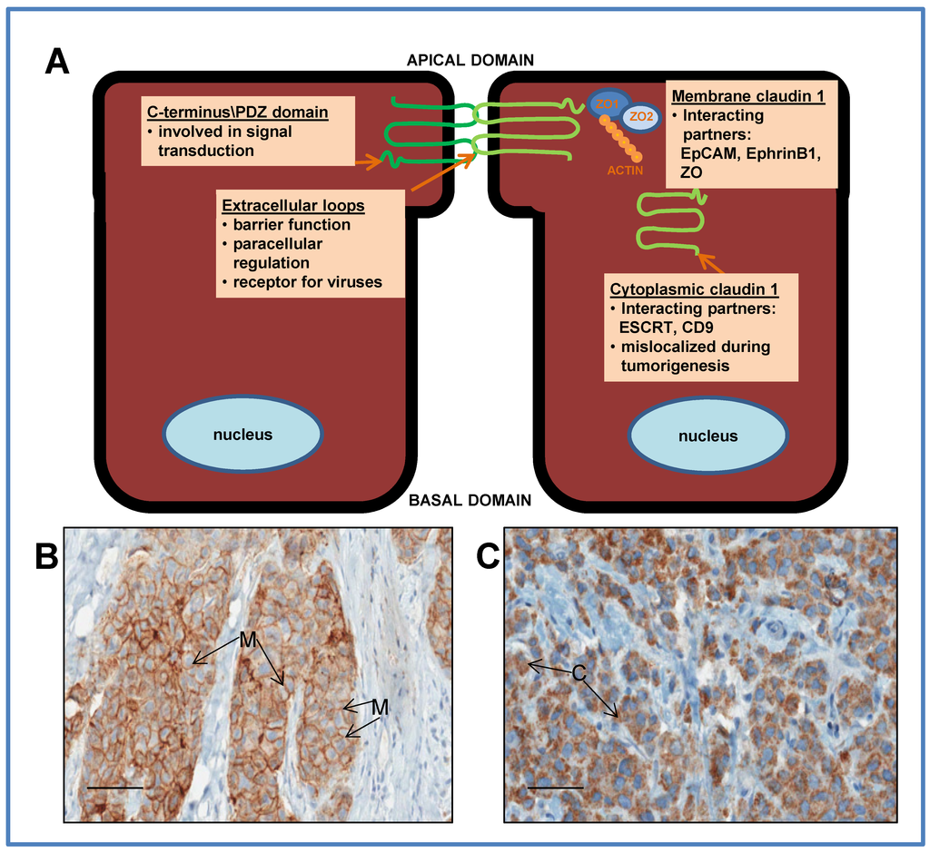 JCM | Free Full-Text | Claudin 1 in Breast Cancer: New Insights