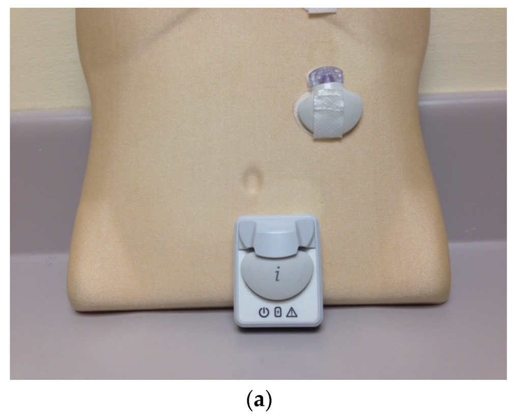An Overview of Insulin Pumps and Glucose Sensors for the Generalist