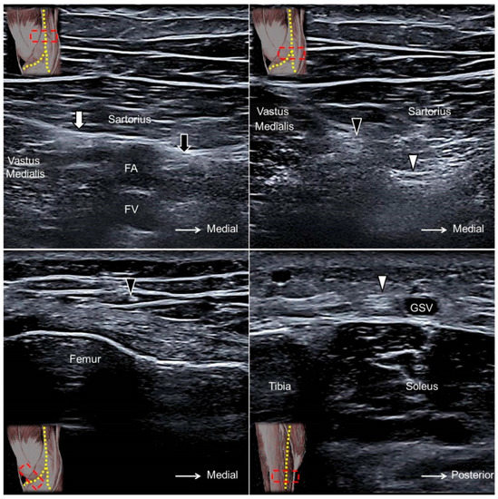 Ultrasound Imaging for the Cutaneous Nerves of the Extremities and ...
