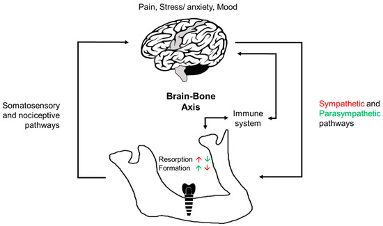 Etiology and Measurement of Peri-Implant Crestal Bone Loss (CBL)