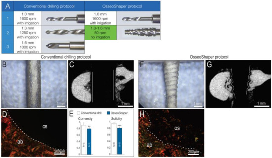 A Novel Osteotomy Preparation Technique to Preserve Implant Site ...